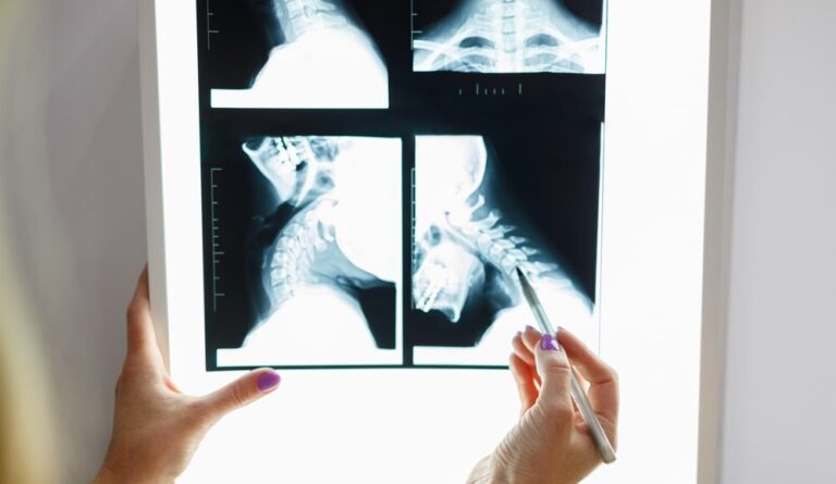 What Can X-rays Detect? Explore Injuries and Conditions