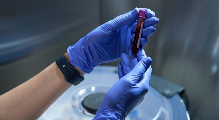 How Often Should You Get Blood Work Done?